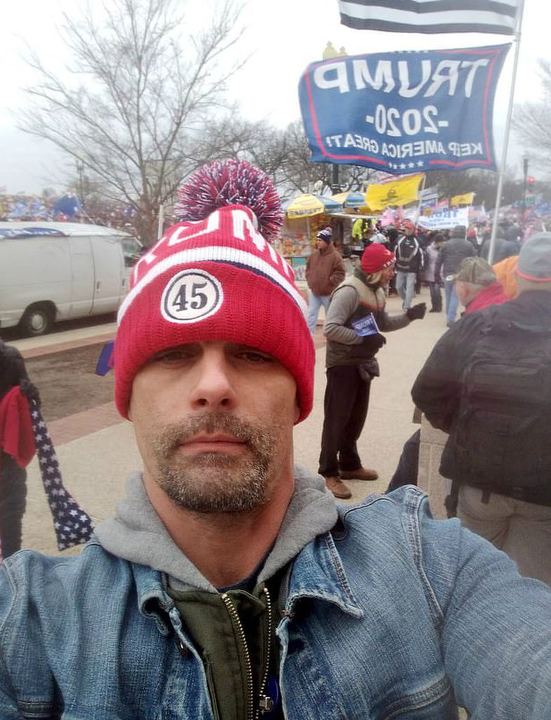 Jason Alexander Hårtransplantasjon