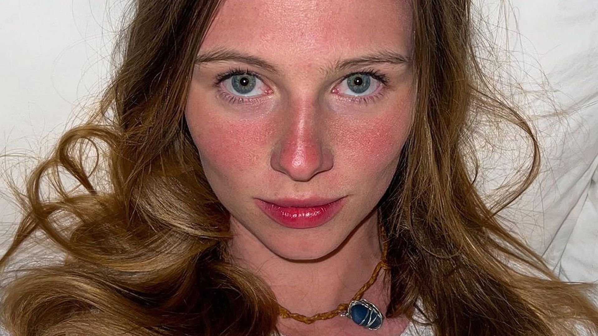 Traurige Vergangenheit: Ann-Kathrin Bendixen wurde gemobbt