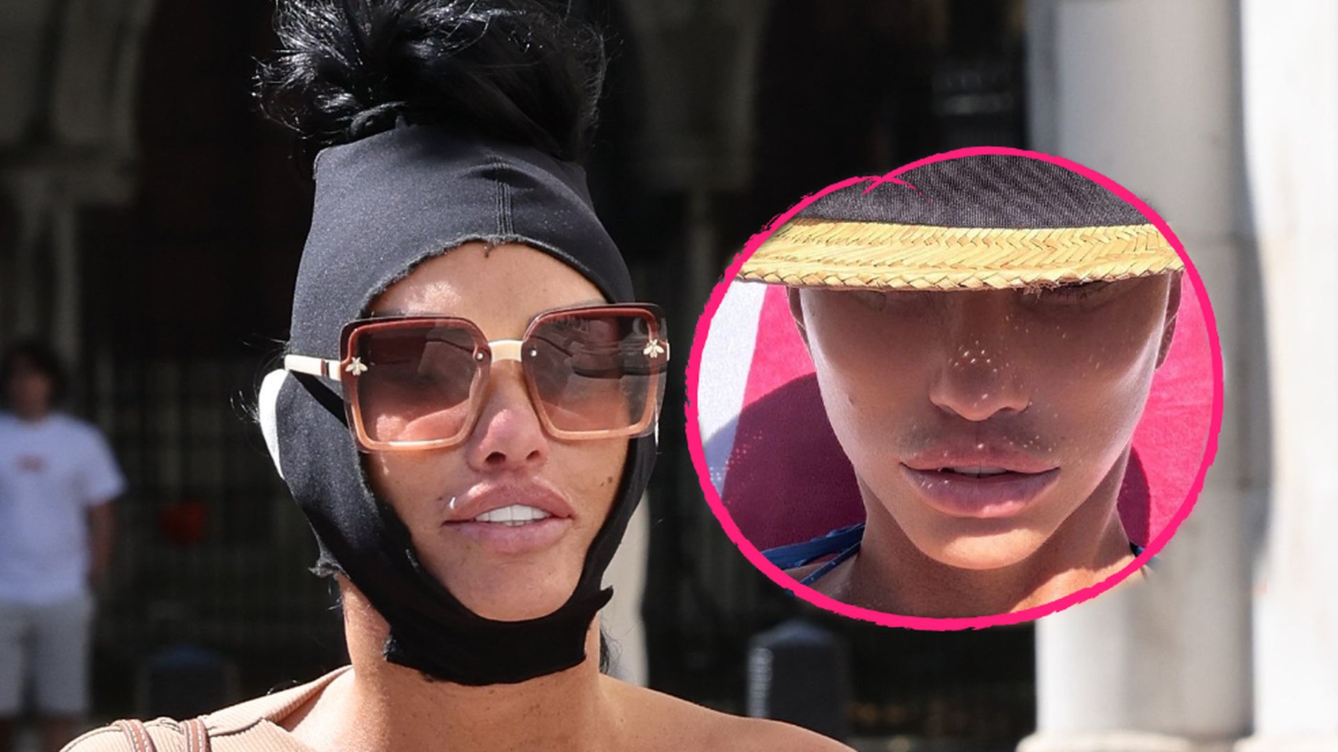 Nach Facelift: Katie Price zeigt sich erstmals ohne Bandagen