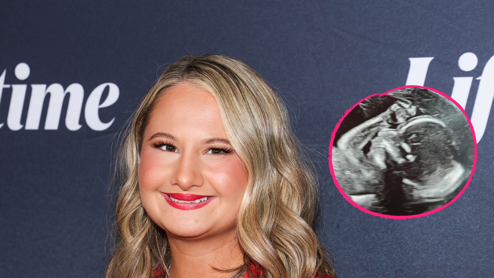 Gypsy Rose Blanchard zeigt Ultraschallfoto ihres Mädchens