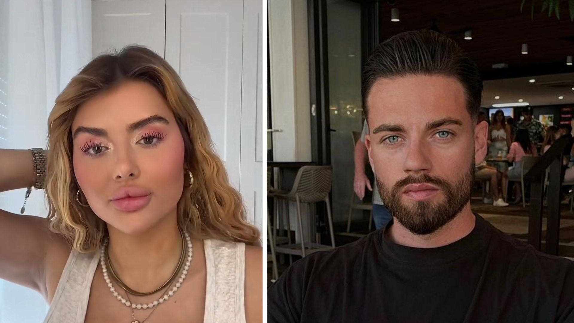 "Ex on the Beach"-Jenny gibt Ex Schuld an ihren Beauty-OPs