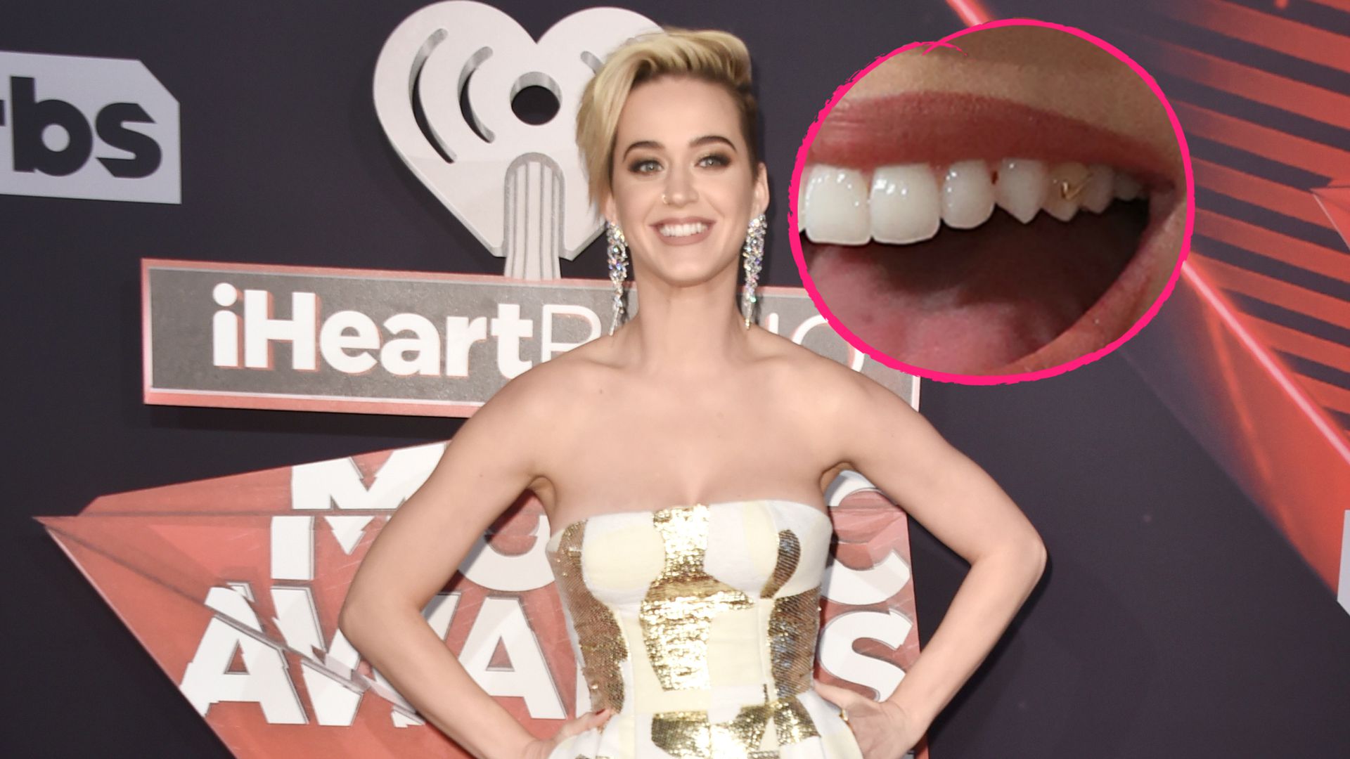Humor nach Red-Carpet-Fail: Katy Perry sucht neue Freunde | Promiflash.de