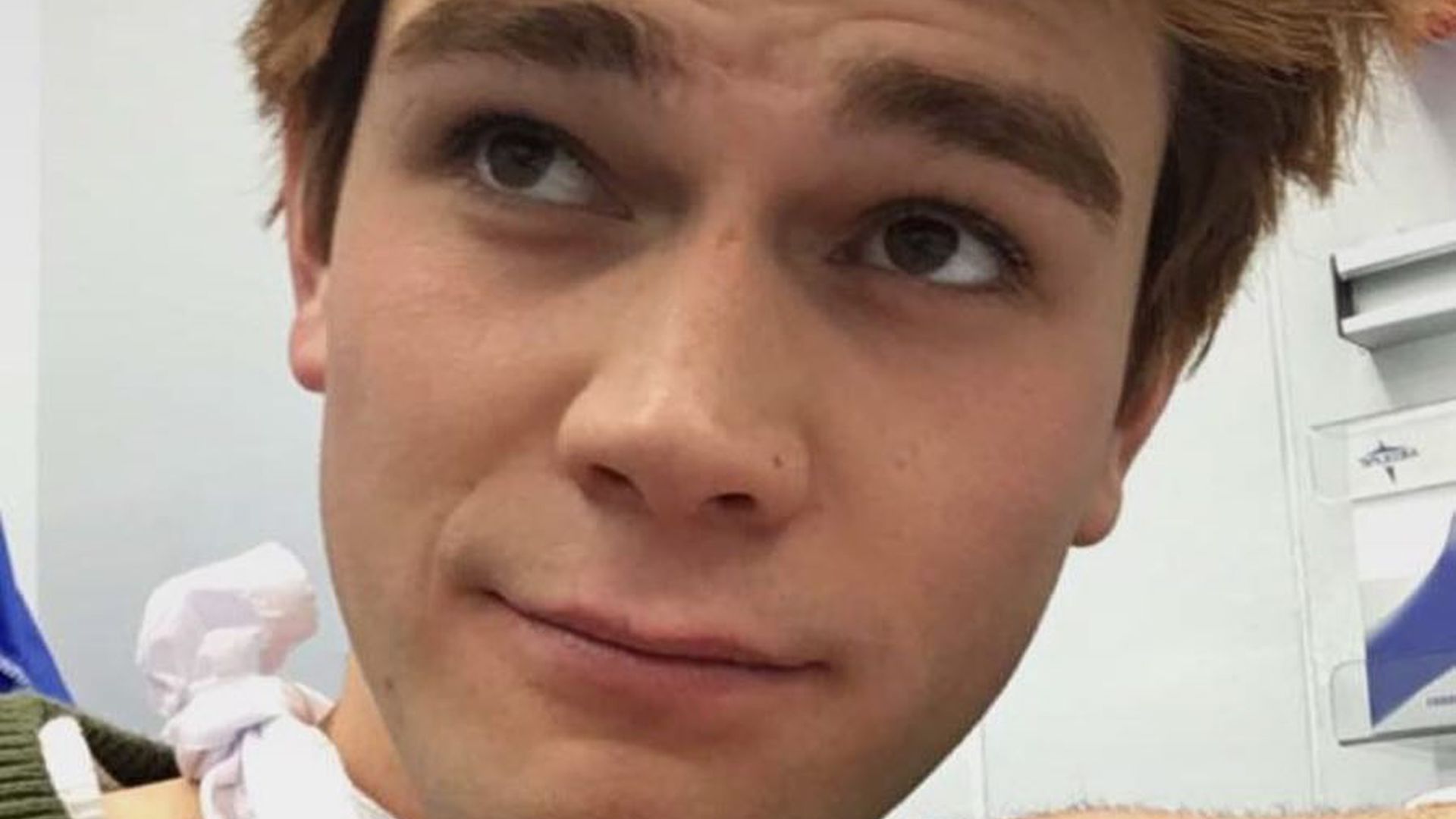 Wespe? Schlägerei? "Riverdale"-KJs Hand ist mega-geschwollen ...