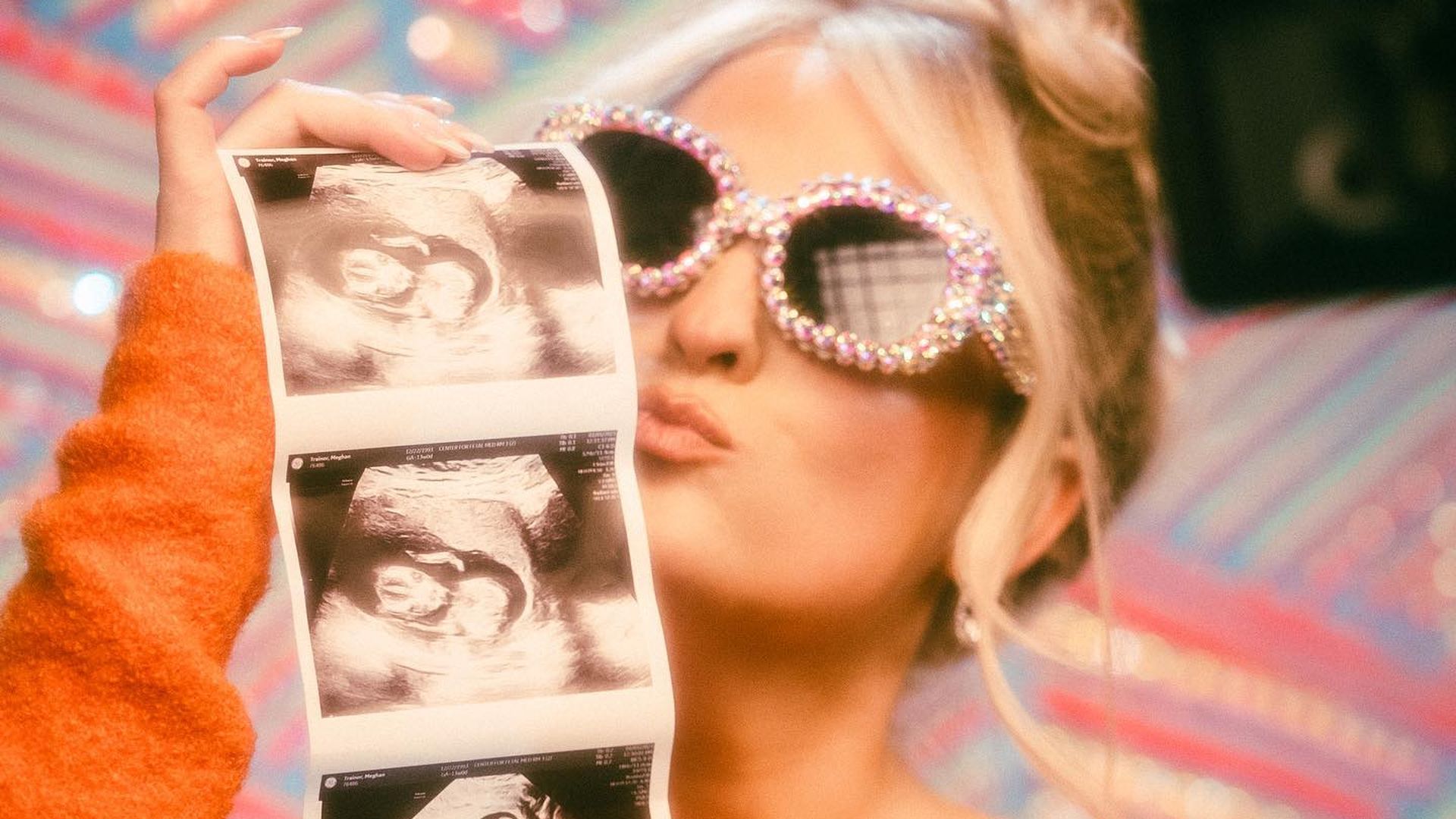 Nach Sohn Riley: Meghan Trainor und Daryl erwarten Nachwuchs