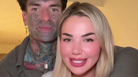 Krebs im Endstadium: So geht Patrice Aminati mit Diagnose um